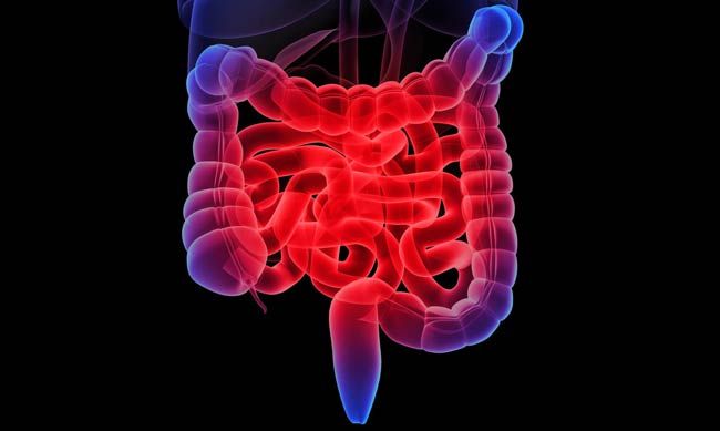 Inflammatory Bowel Disease (IBD) Causes, Symptoms, Complications ...